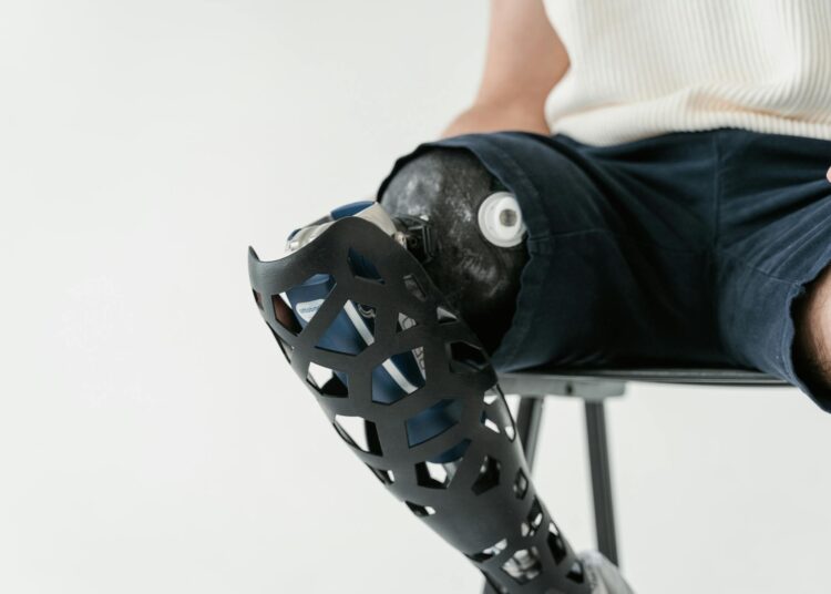 Brain-Controlled Bionic Legs: Prosthetic Legs That Can More With Your ...